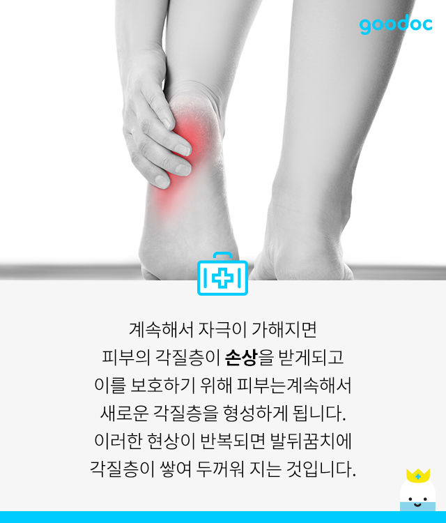 남자들이 말하는 내 여친의 이것만은 못참는다! - 인스티즈(instiz) 이슈 카테고리