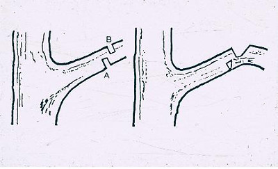 올바른 가지치기 - 전지 전정 및 관리 - 아파트와나무