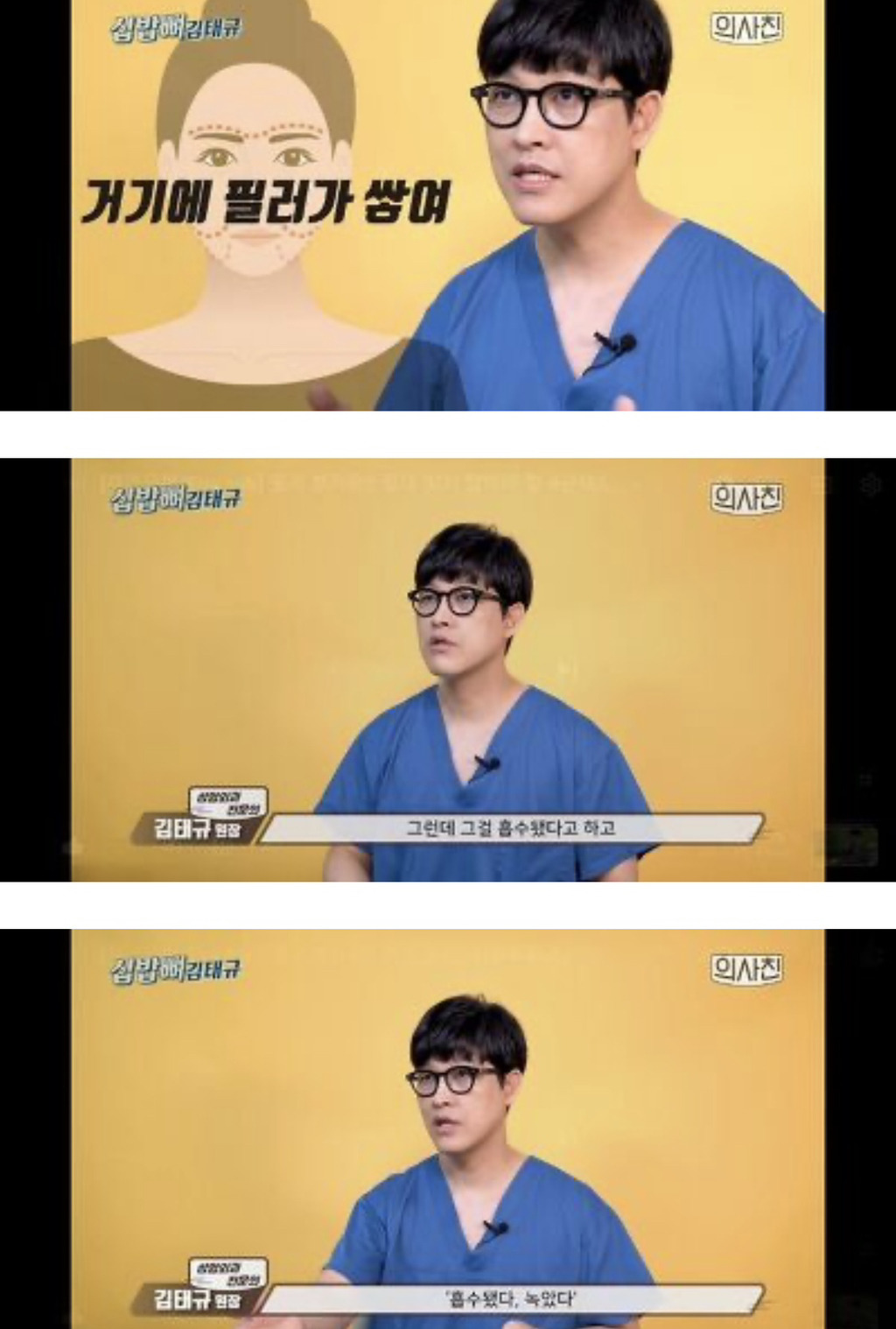 더쿠 - 의사피셜 필러 절대 맞지 말아야 할 4군데