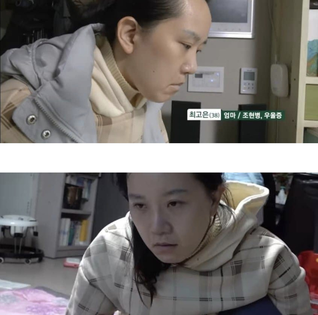 더쿠 두 아이가 모두 다운증후군인 부부