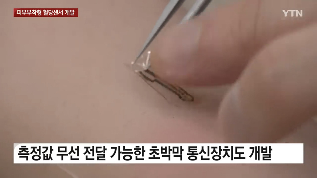 다이어트 클럽 당뇨 환자에 희소식피부 부착형 혈당 센서 개발 Daum 카페