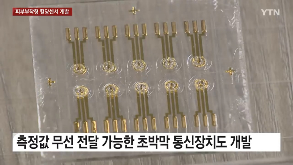 다이어트 클럽 당뇨 환자에 희소식피부 부착형 혈당 센서 개발 Daum 카페
