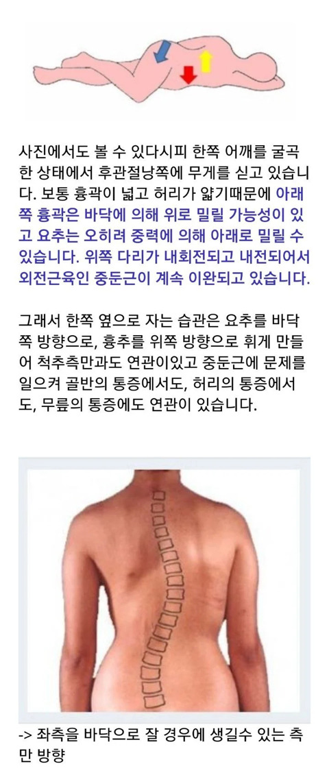 병약한 여성을 위한 공간 허리 척추 골반 한번에 아작나는 자세 Daum 카페