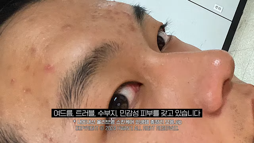 화장품 추천 민감성 피부 유튜버가 추천하는 내돈내산 스킨케어 찐템 Daum 카페