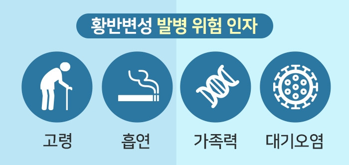 인구 고령화로 급증하는 실명 질환 황반변성