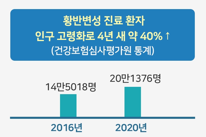 인구 고령화로 급증하는 실명 질환 황반변성