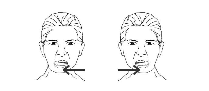 당신의 거북이는 안녕합니까? - 치료적 접근의 운동