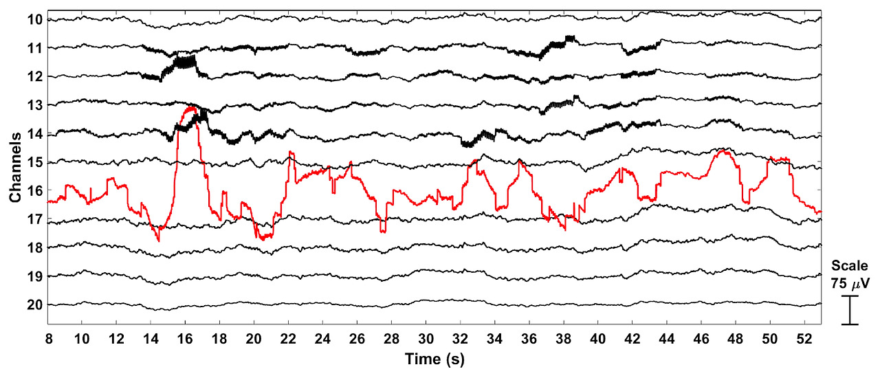 EEG의 거의 모든 것 4편