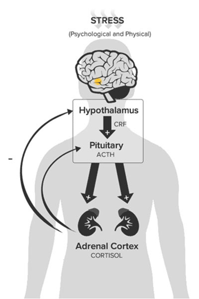[심플 운동] 스트레스 공식의 발견