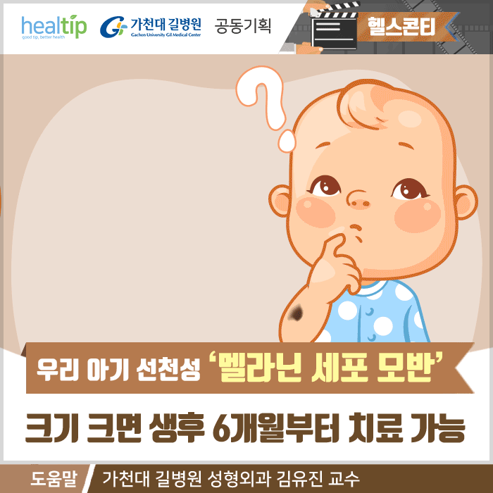 우리 아기 선천성 ‘멜라닌 세포 모반
