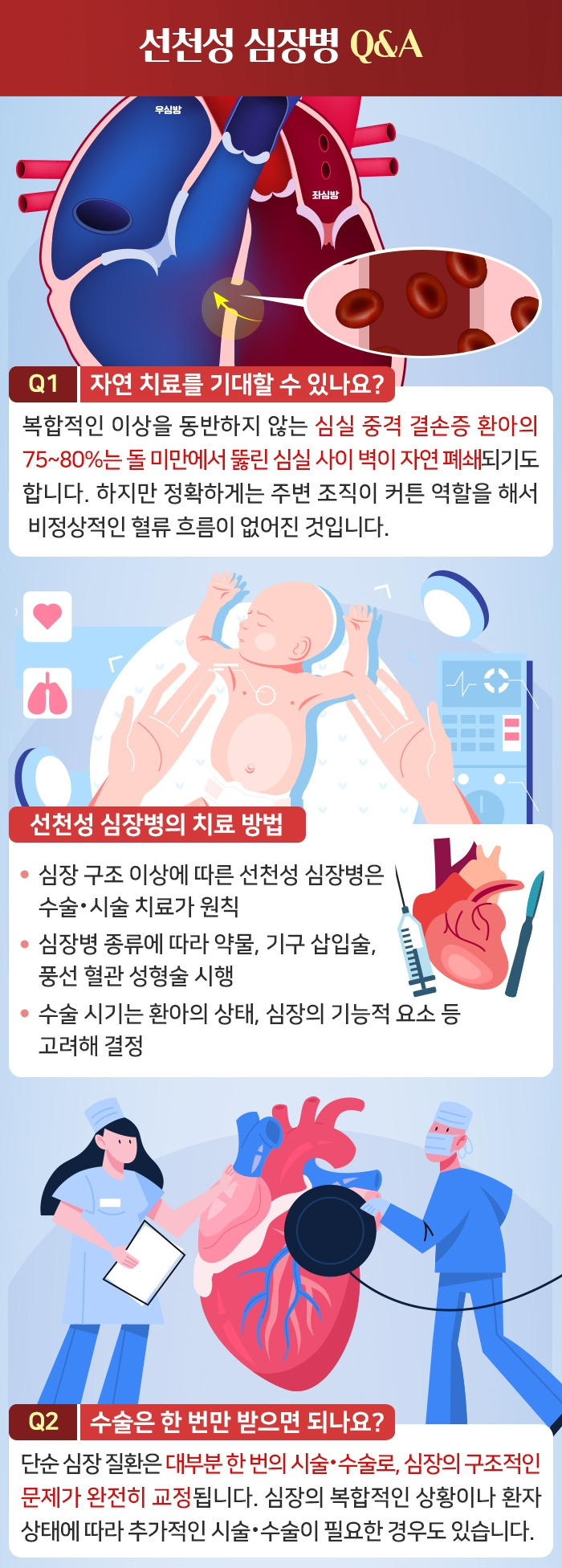 신생아 ‘선천성 심장병 ②