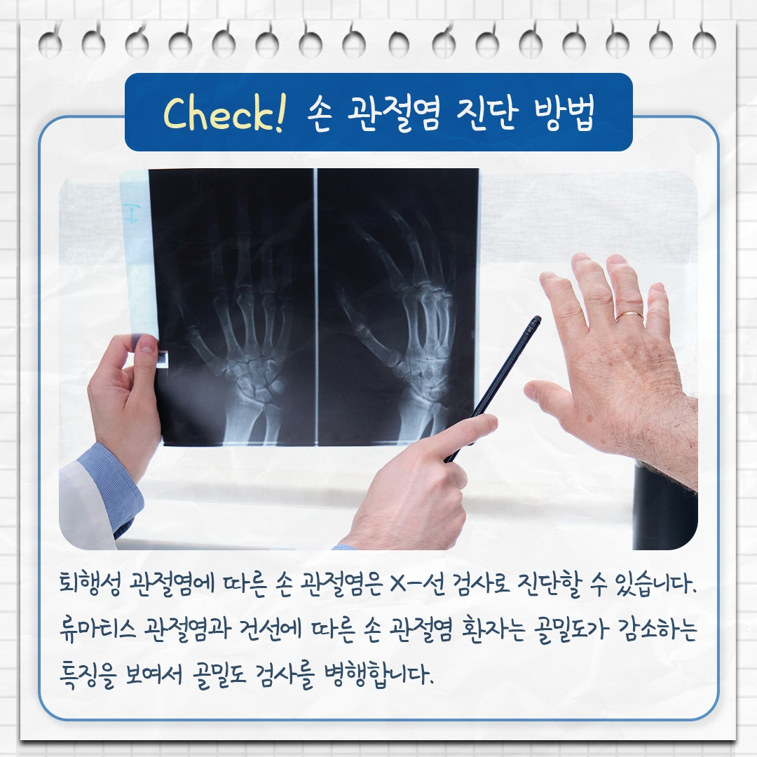손가락이 붓고 아파요‧‧‧