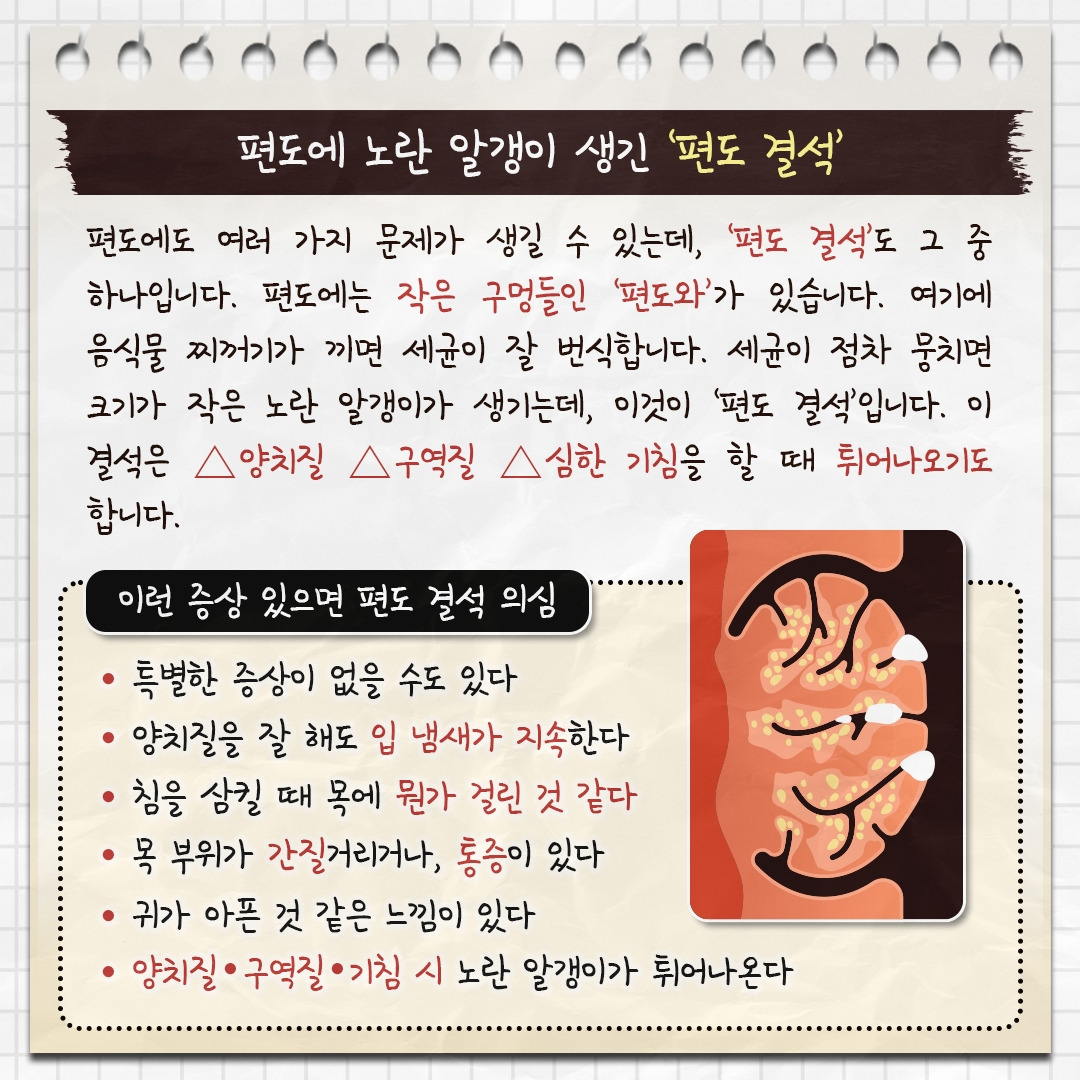 기침할 때 ‘노란 알갱이가 튀어나오면