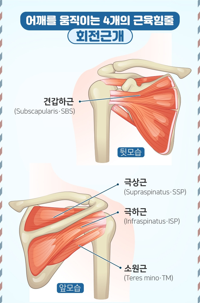 어깨 힘줄 끊어진 ‘회전근개파열