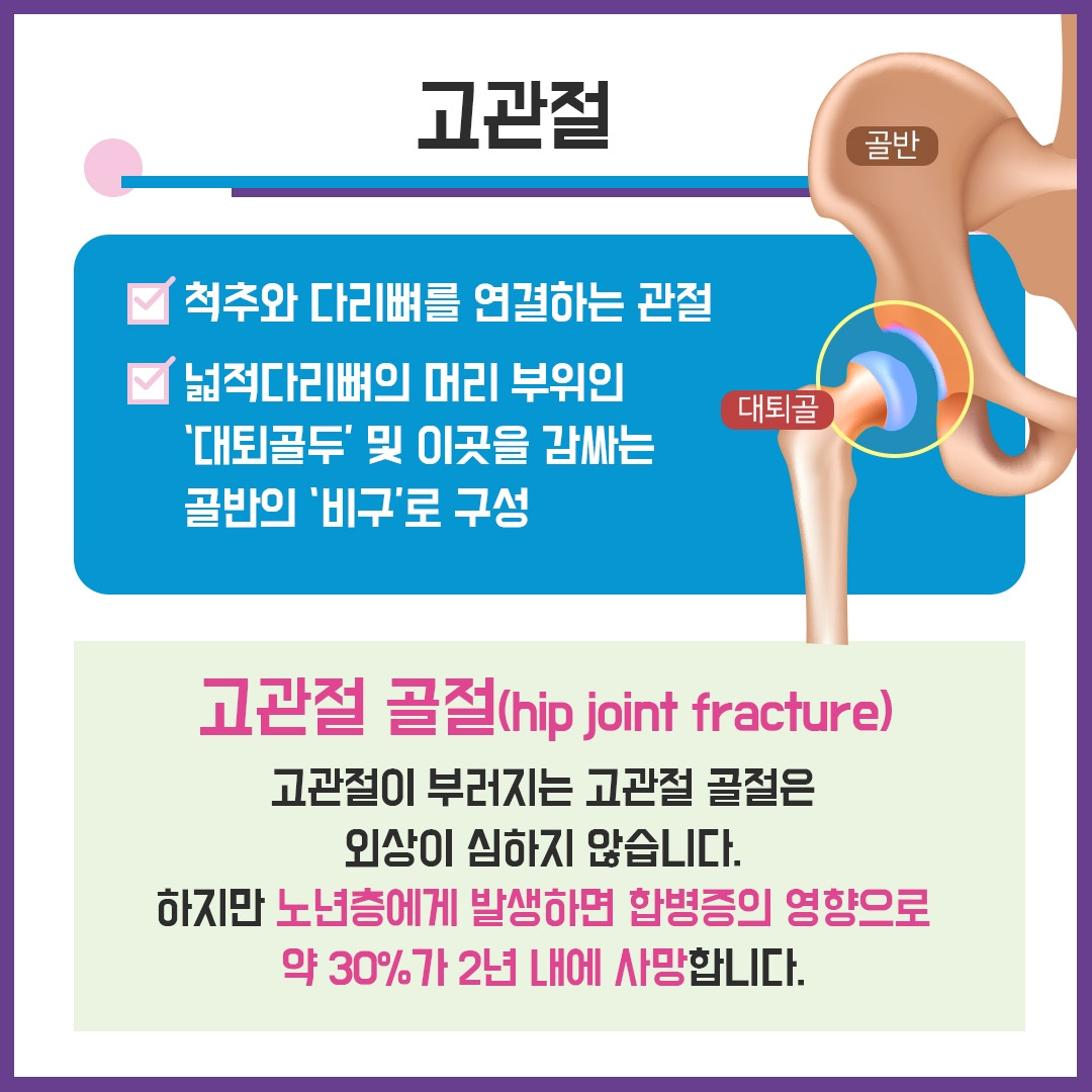 일상생활 속 노인 생명 노리는 ‘고관절 골절