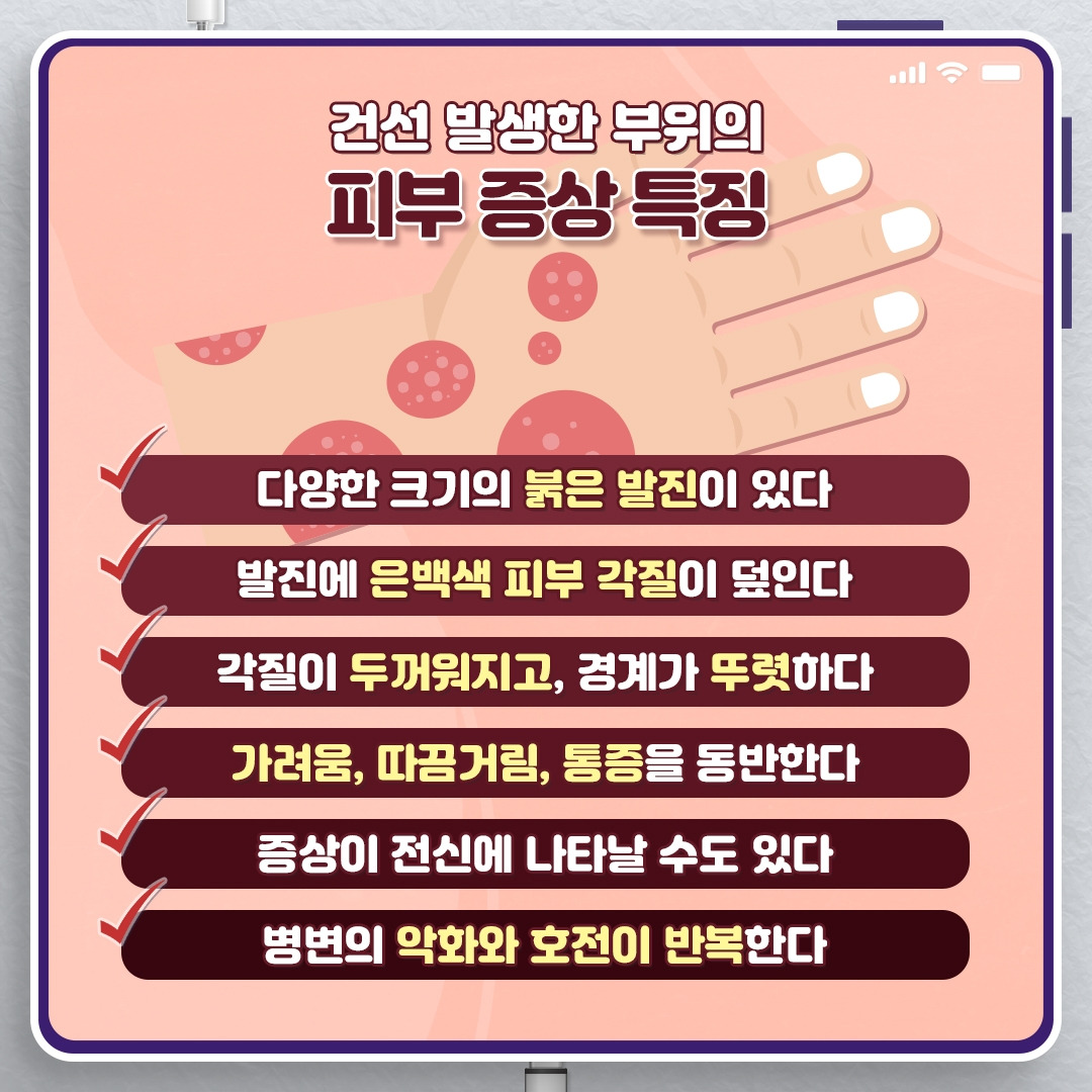 ‘건선은 피부 질환이다