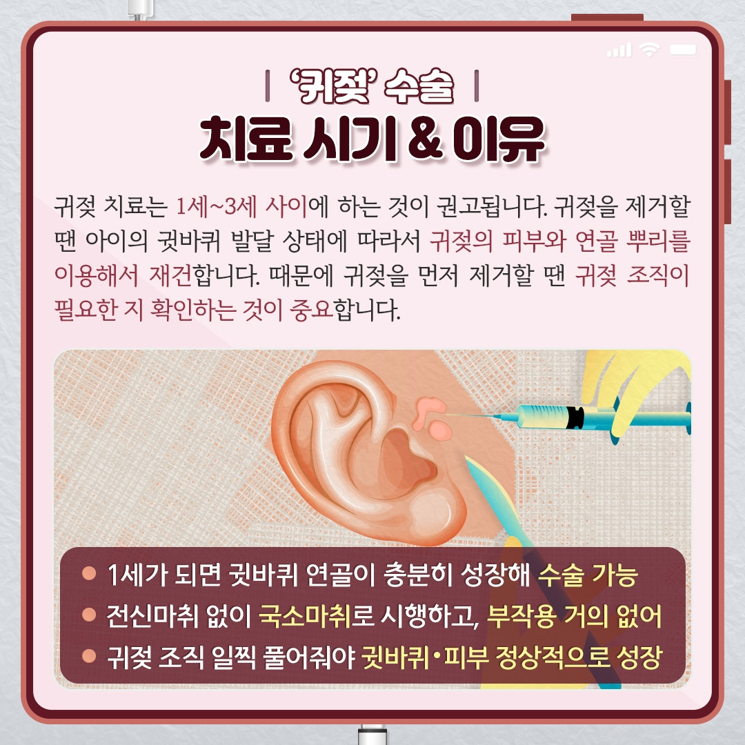 갓 태어난 아기 귀에 달린 귀젖
