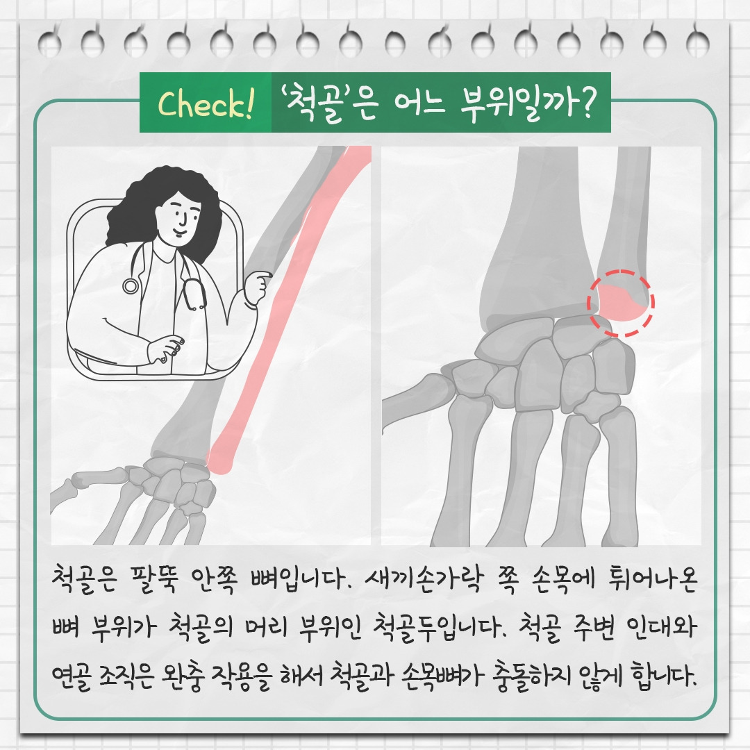 새끼손가락 쪽 손목 계속 아픈가요?