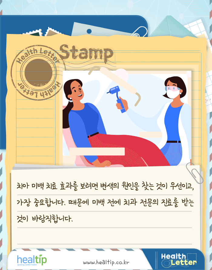 치아 미백 후 잇몸에 화상