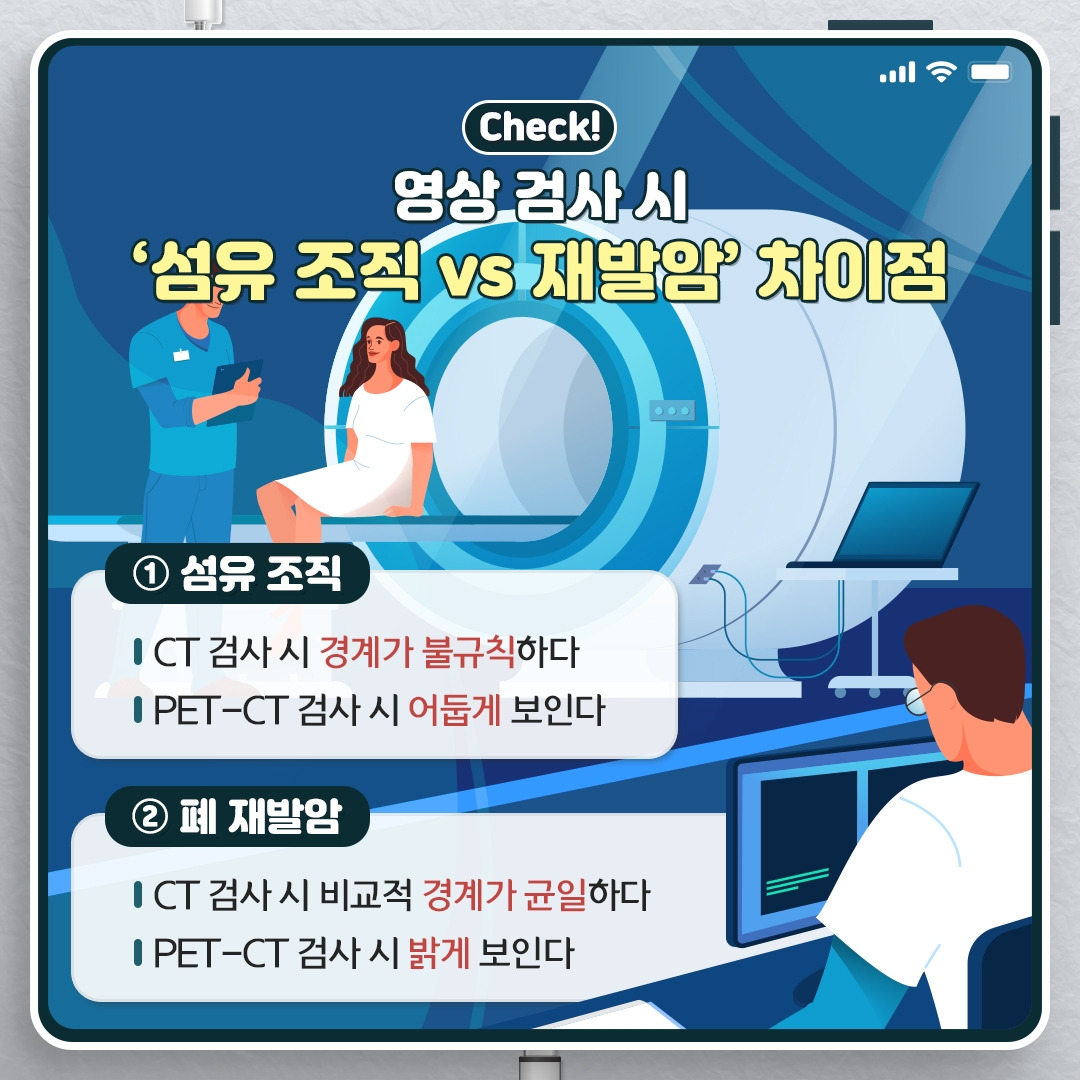 폐암 방사선 치료 후 생긴 ‘섬유 조직