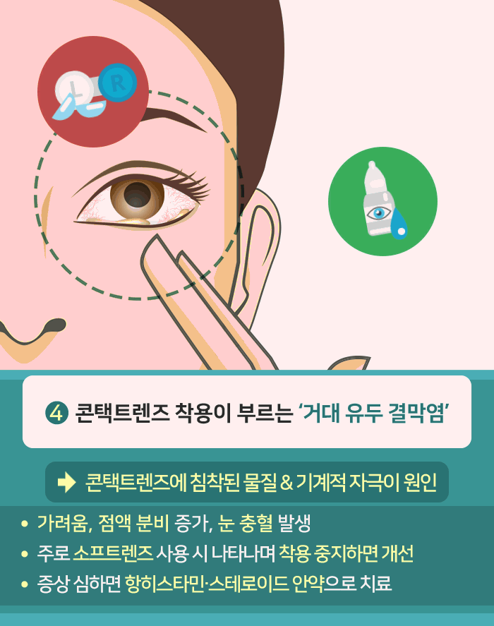 단순한 눈 불편감에 그치지 않아요
