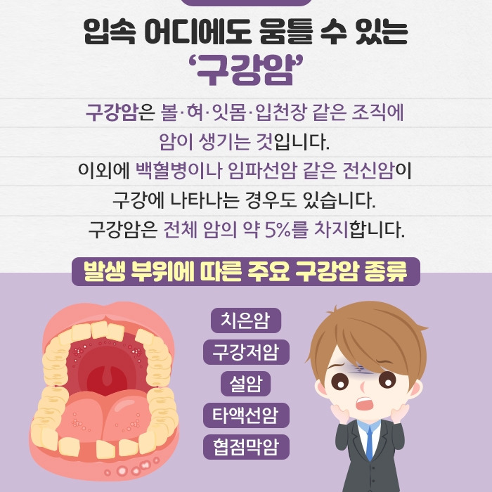 초기 진단 힘든 ‘구강암 조기에 발견하려면