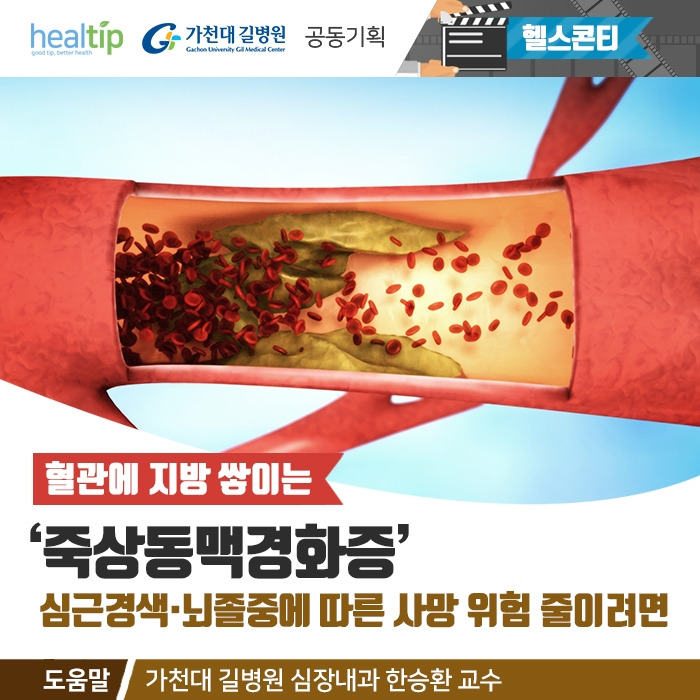 혈관에 지방 쌓이는 ‘죽상동맥경화증