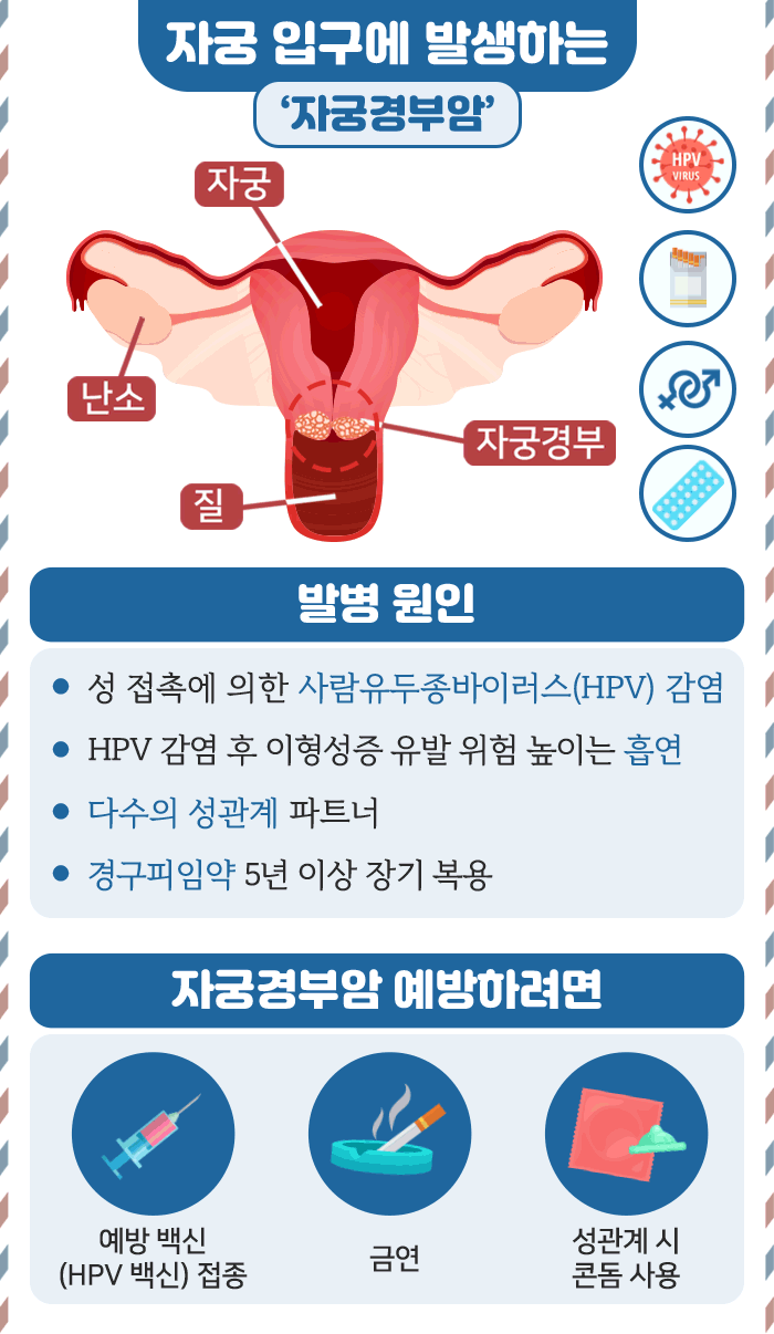 여성 위협하는 ‘자궁암