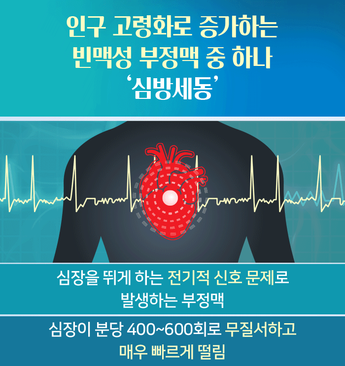 뇌졸중 위험 높이는 부정맥 ‘심방세동