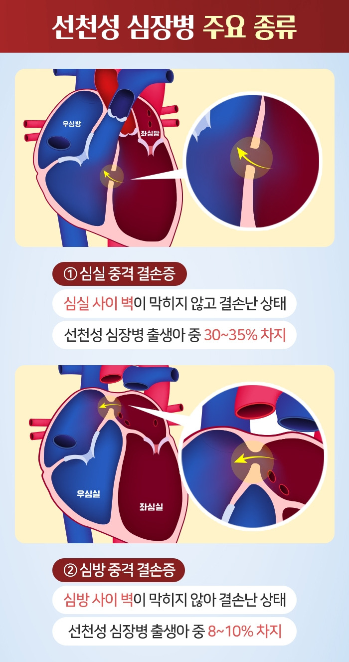 신생아 ‘선천성 심장병 ①
