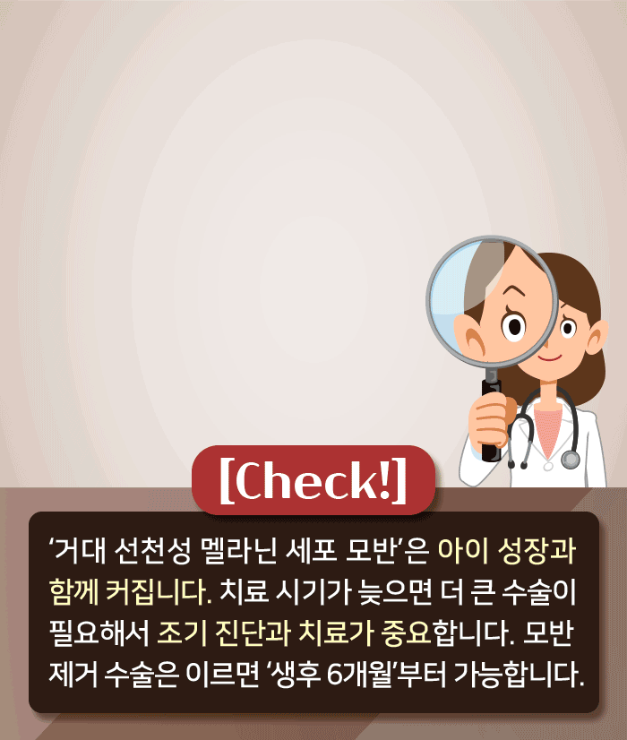 우리 아기 선천성 ‘멜라닌 세포 모반
