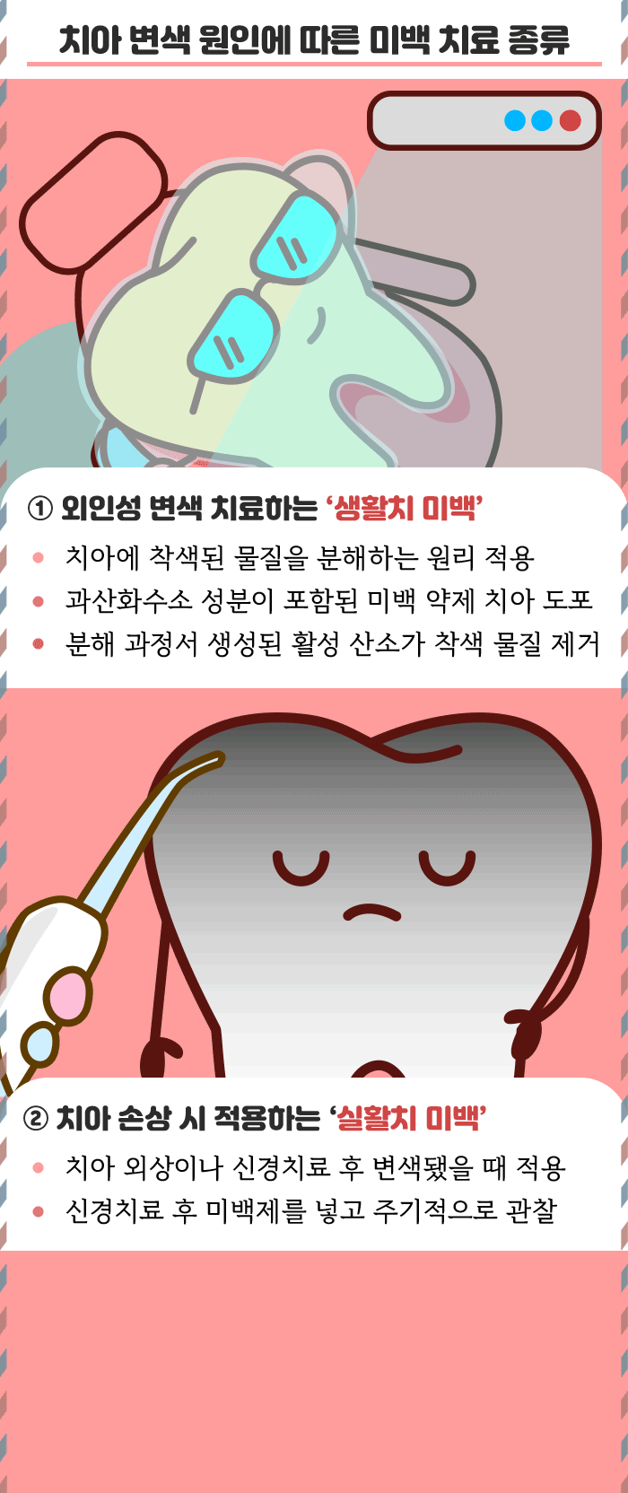 치아 미백 후 잇몸에 화상