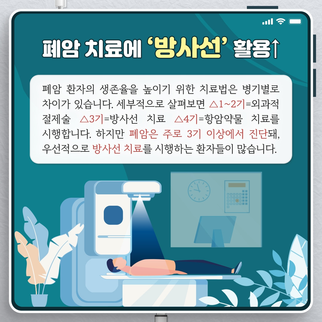 폐암 방사선 치료 후 생긴 ‘섬유 조직