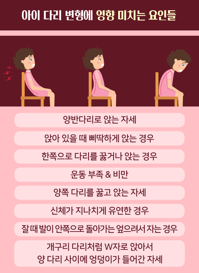 방학 때 살펴보세요 우리 아이 ‘휜 다리