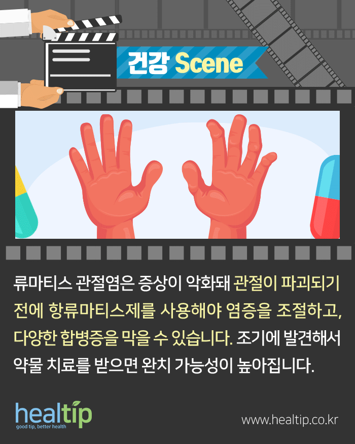 예방법 없는 ‘류마티스 관절염