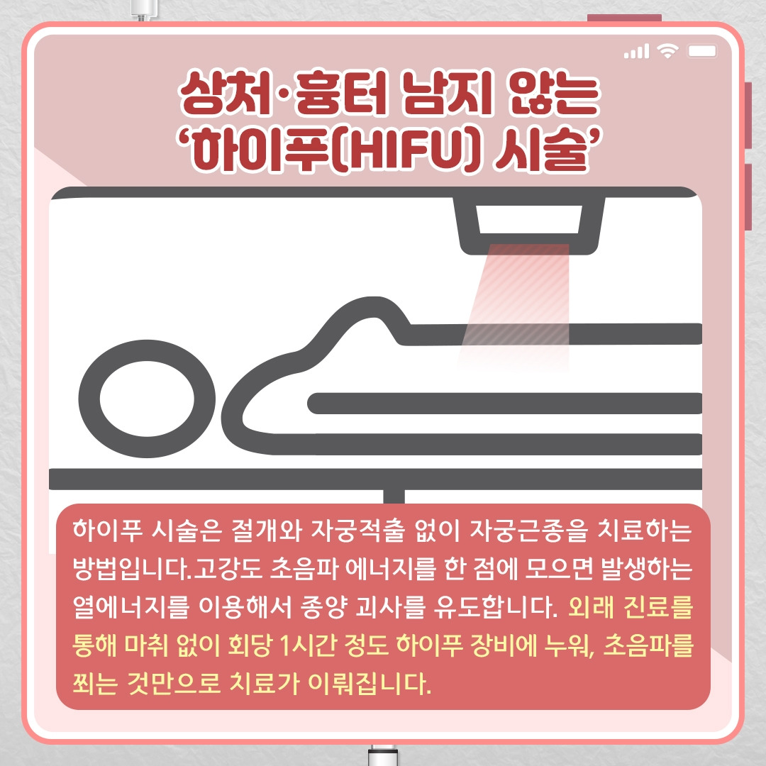 폐경 전 가임기 여성의 적
