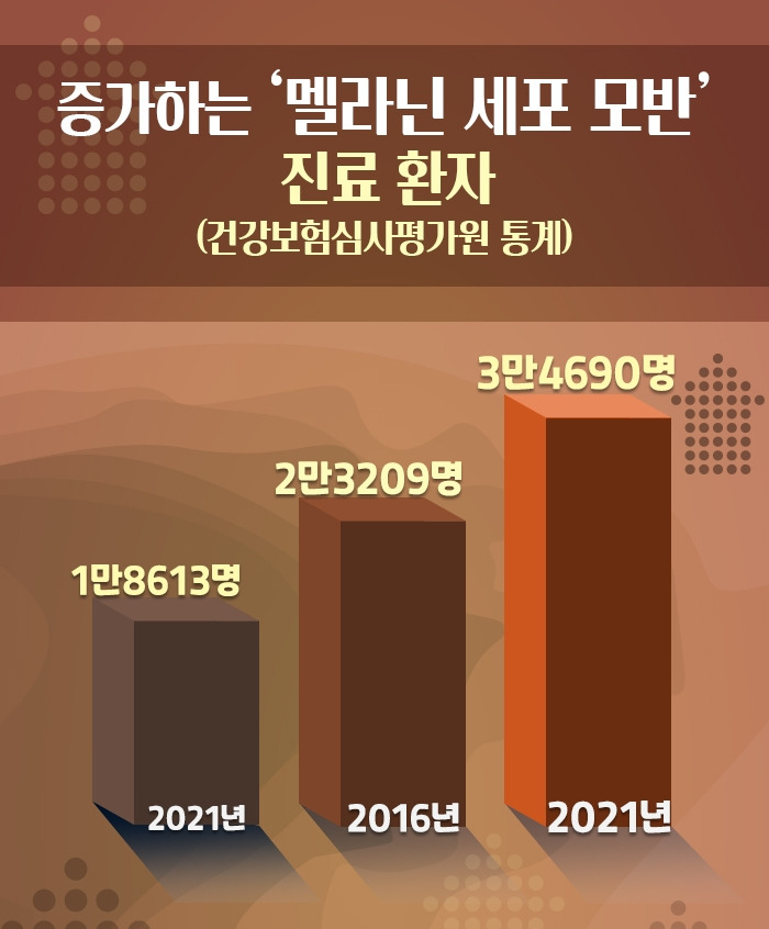 우리 아기 선천성 ‘멜라닌 세포 모반