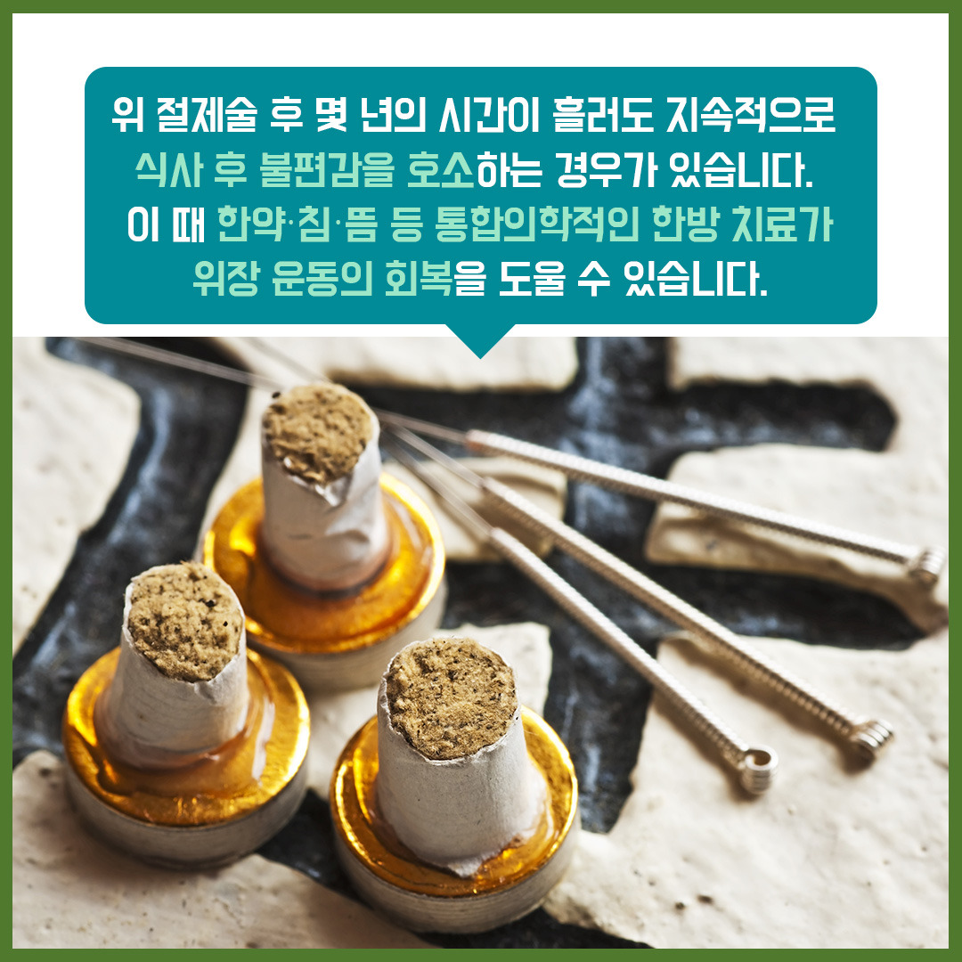 위 절제술 받은 위암 환자