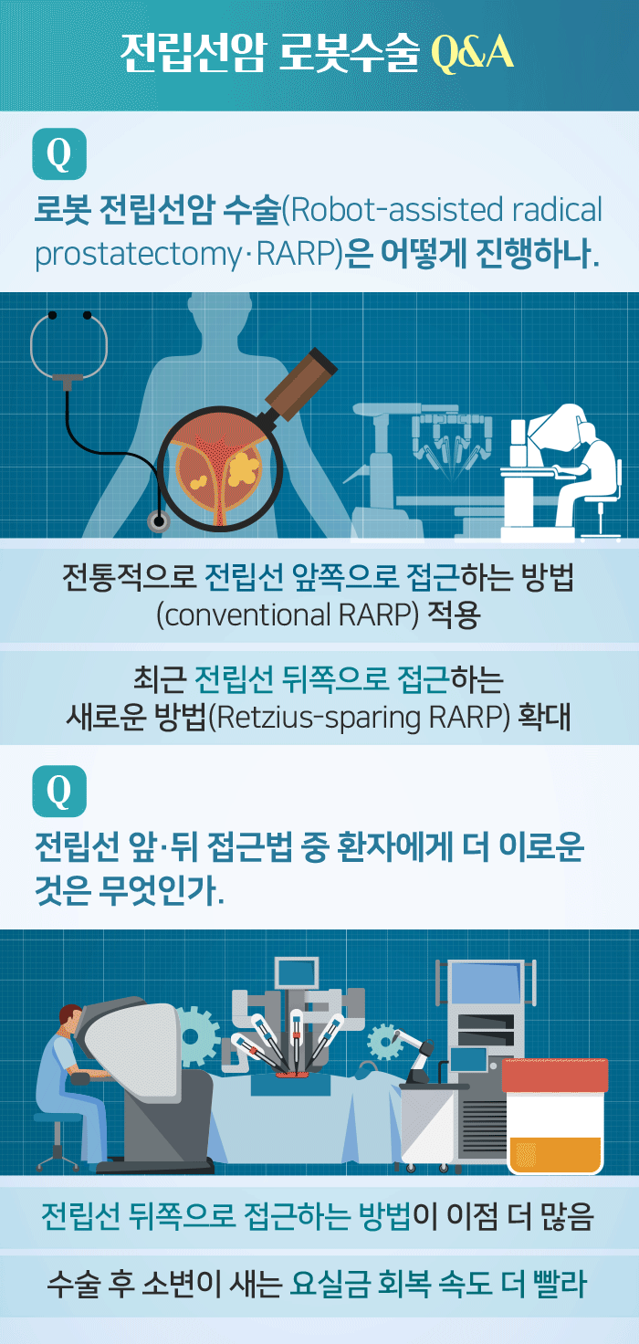 대표적인 남성암 ‘전립선암
