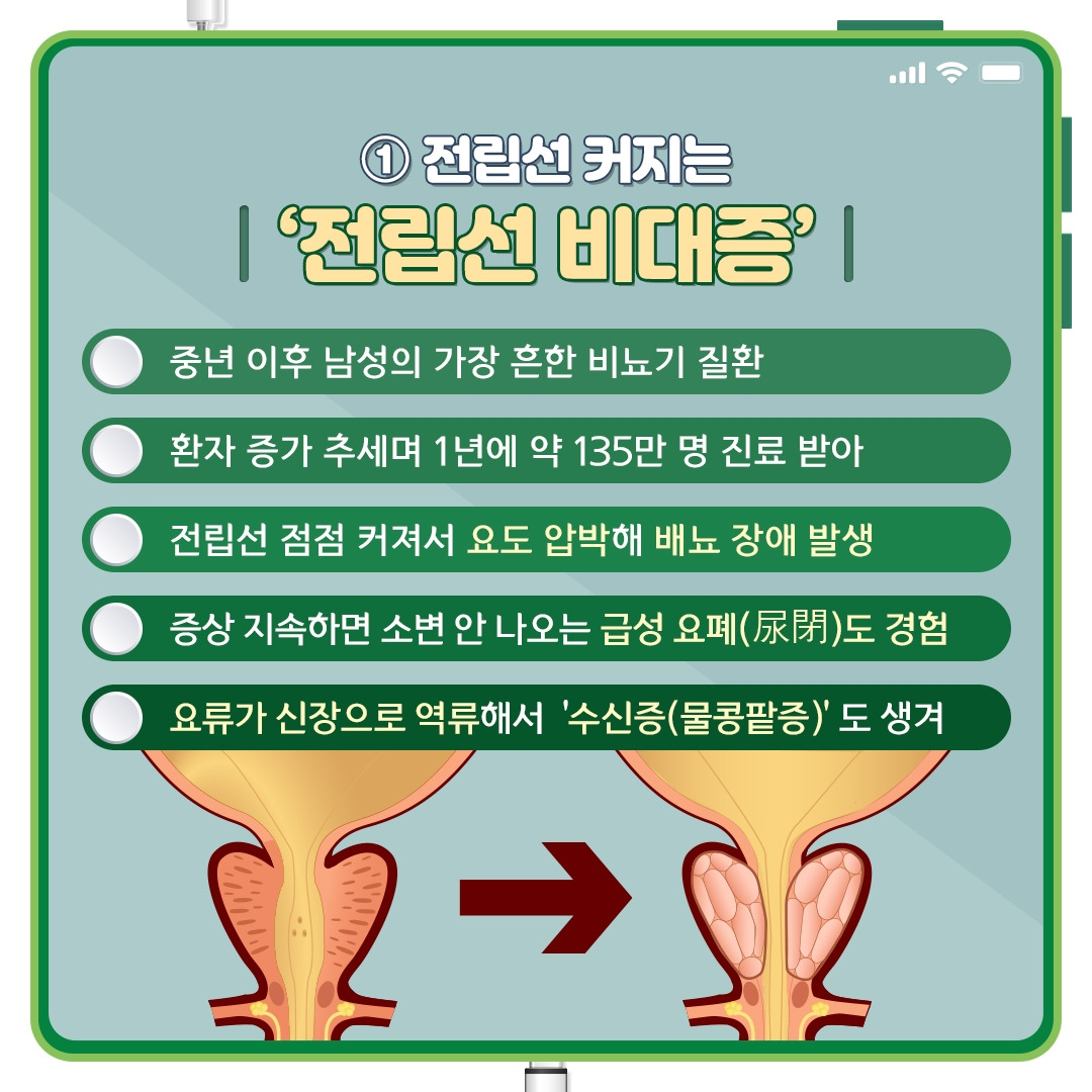 전립선 비대증 And 전립선암