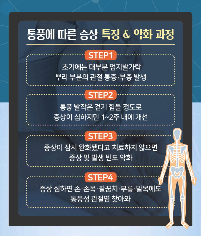 술‧육류 즐기는 남성의 질환 ‘통풍