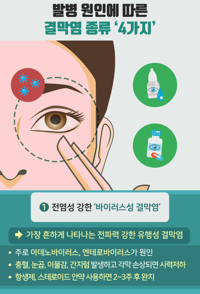 단순한 눈 불편감에 그치지 않아요