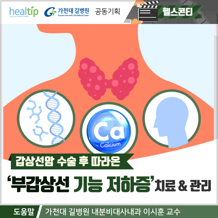 갑상선암 수술 후 따라온