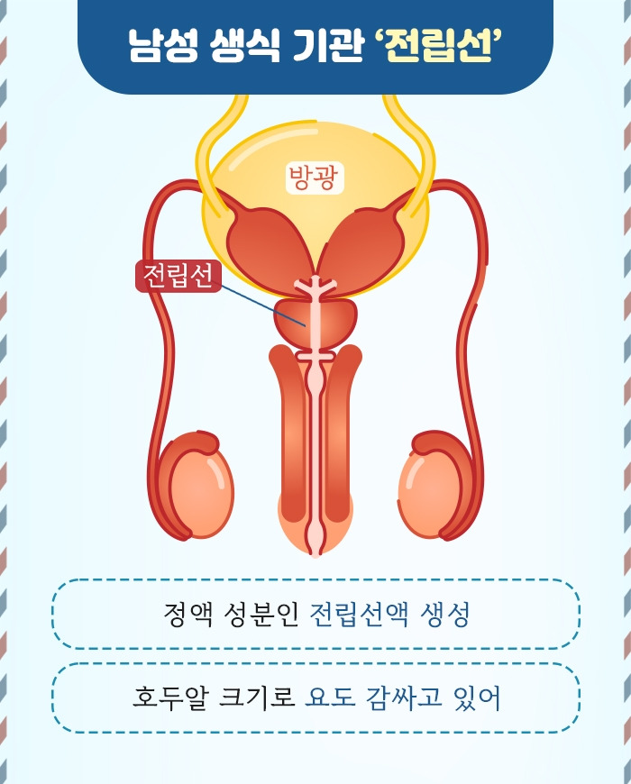 ‘전립선염 증상 악화시켜요