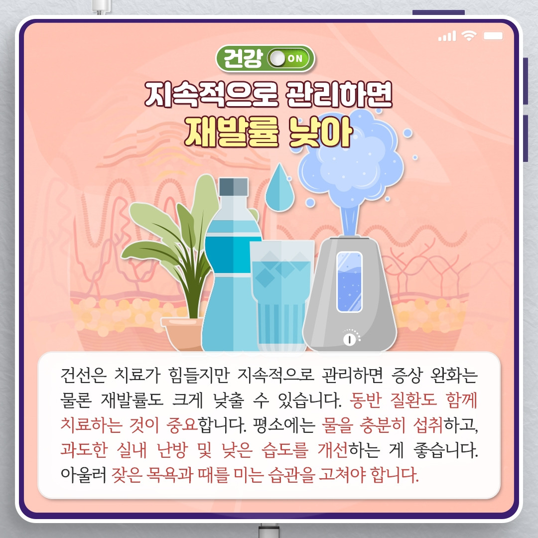‘건선은 피부 질환이다