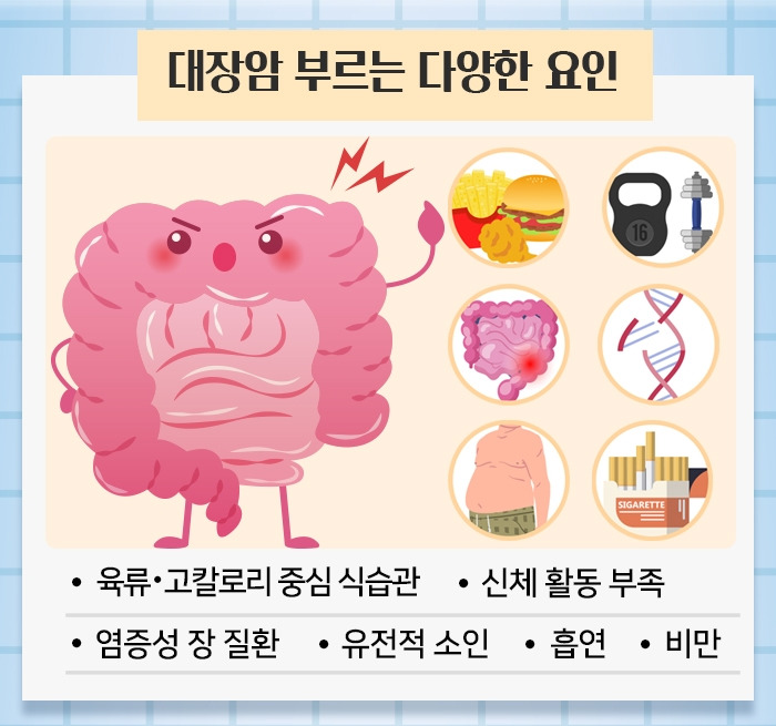 대장암 찾는 ‘대장 내시경