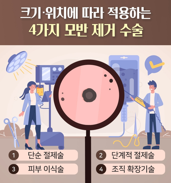 우리 아기 선천성 ‘멜라닌 세포 모반