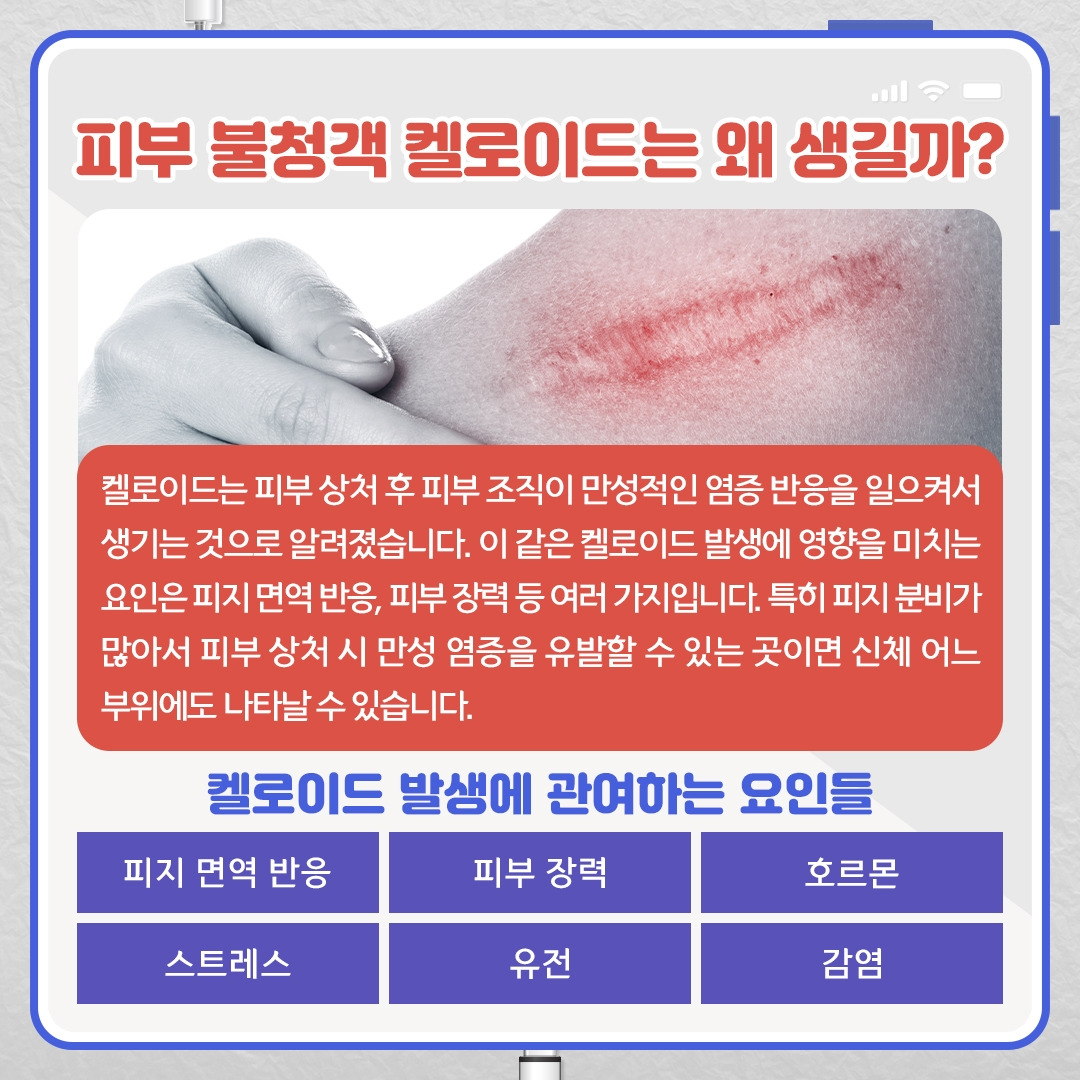 상처 후 점점 커지는 붉은 덩이