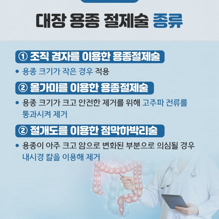 대장암 예방 첫걸음 대장내시경 And 용종 절제