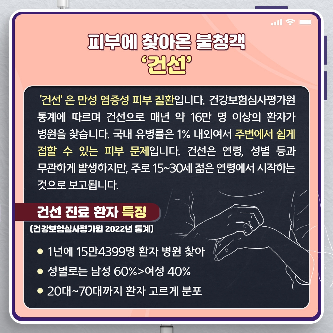 ‘건선은 피부 질환이다